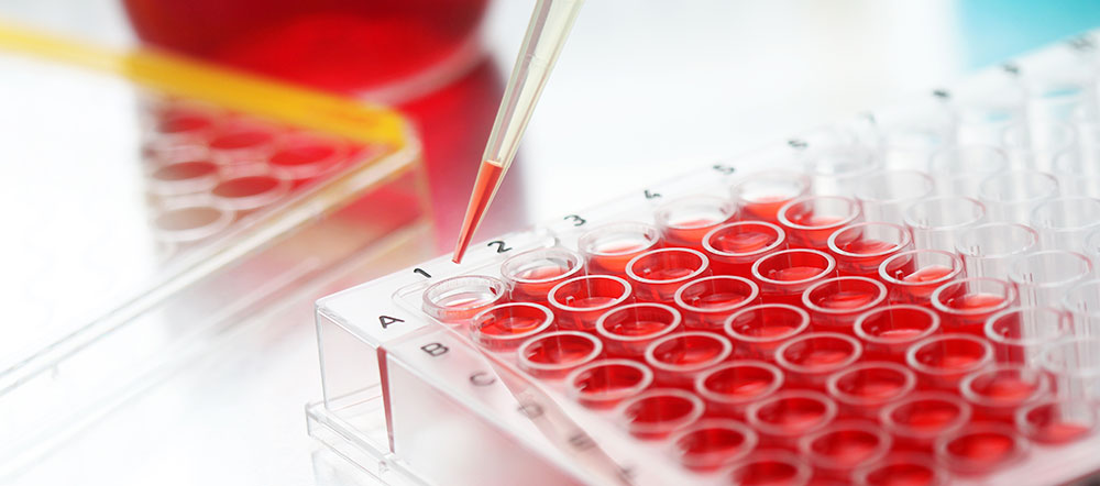 Collaboration in Cell & Gene Therapy | Danaher Life Sciences