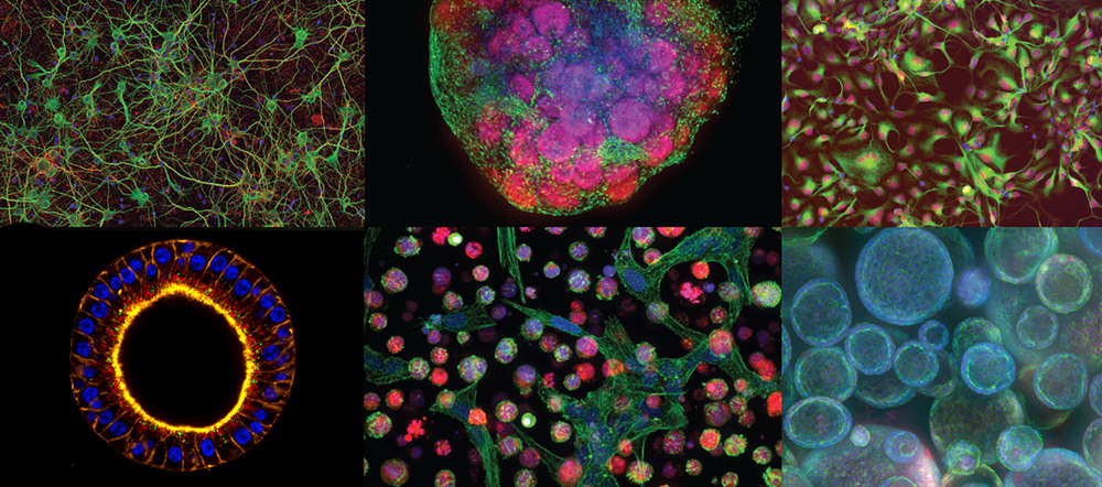 Engineering Next-gen Organoids with Automated Lab Workflows at SLAS ...