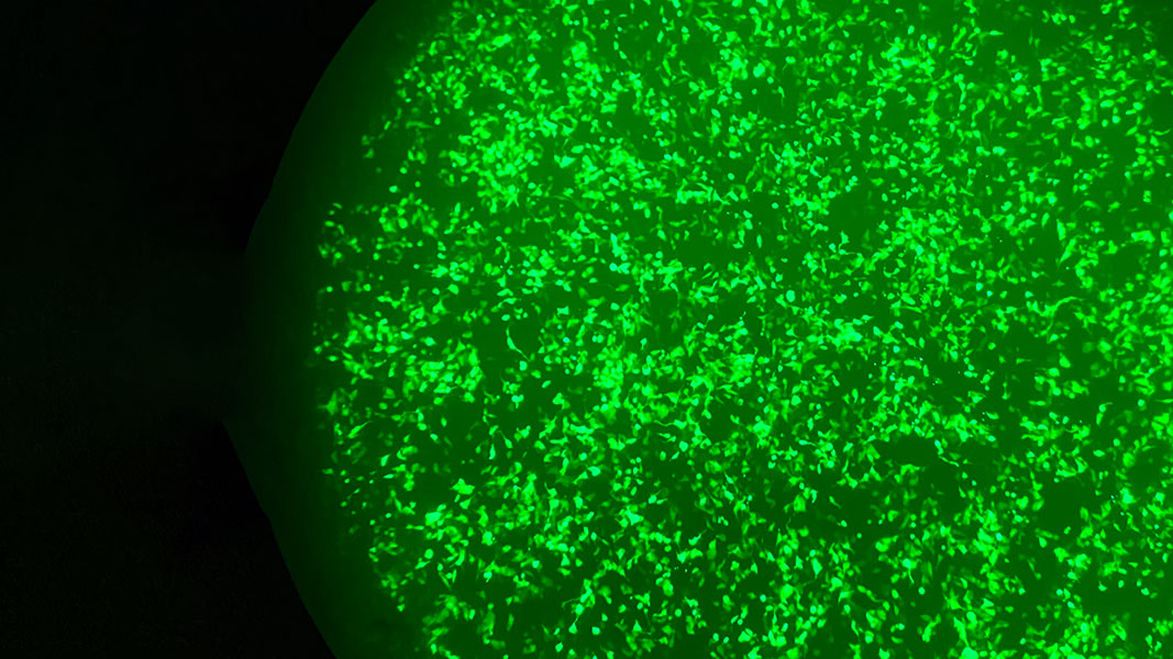 Transfection: Methods, Applications, and Future Directions | Danaher ...