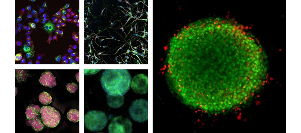 Innovation at Molecular Devices: Updates in Automated, High-Content ...
