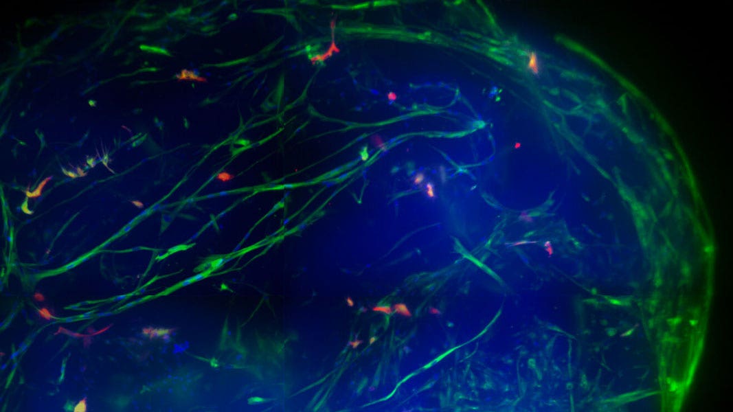 3d Cell Culture In Vitro Modeling Explores New Depths | Danaher Life ...