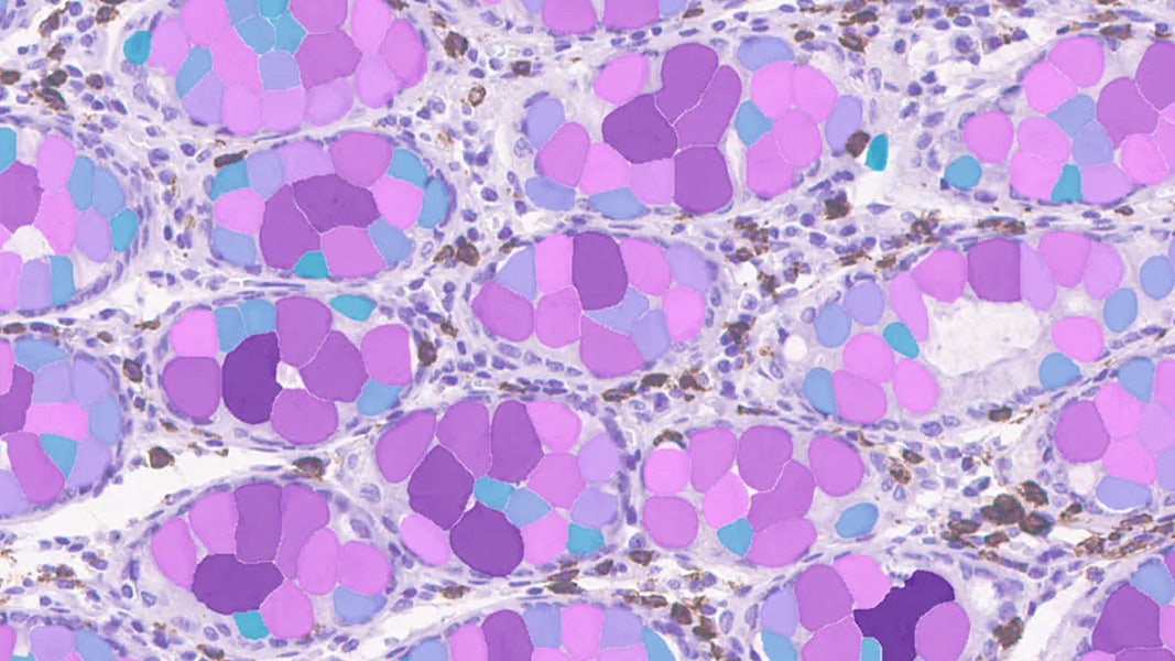 Unlocking Spatial Biology with AI Image Analysis