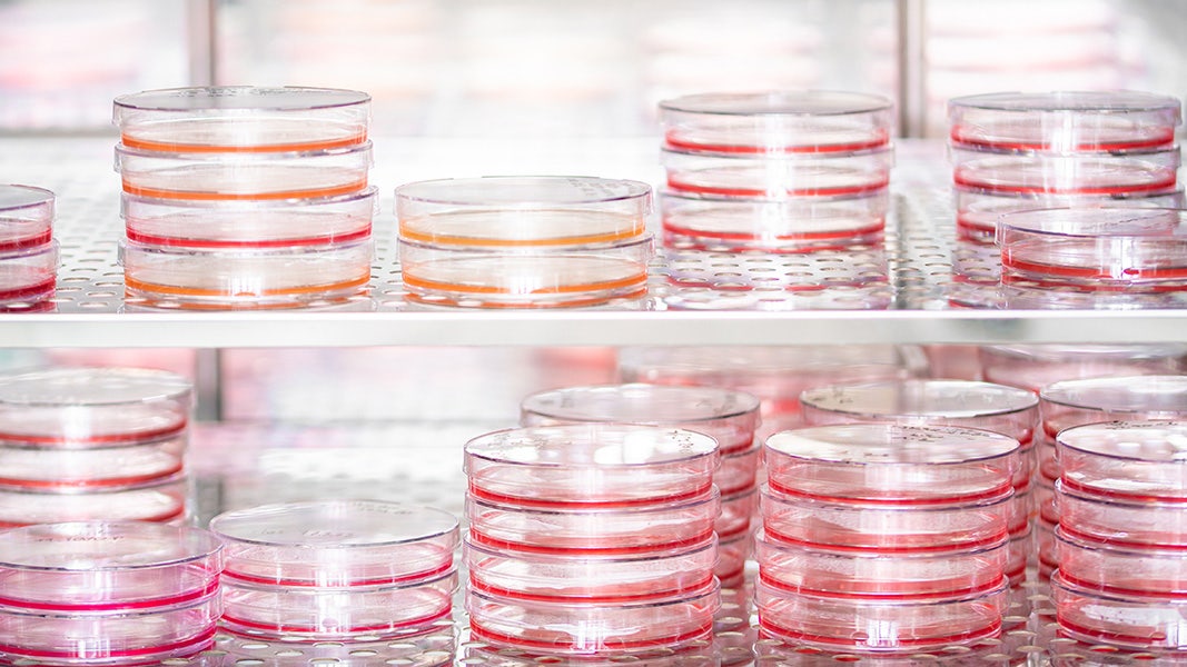 Suspension Cell Culture: Methods, Benefits & Applications | Danaher ...