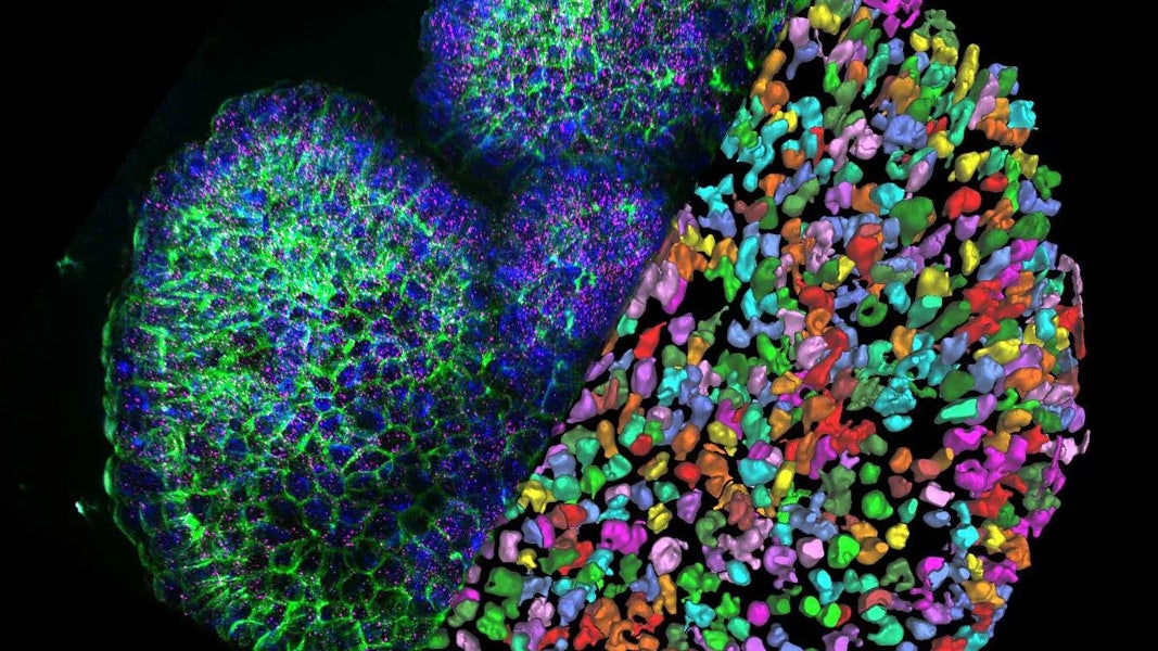 AI-Powered Software Enhances 3D Image Analysis | Danaher Life Sciences