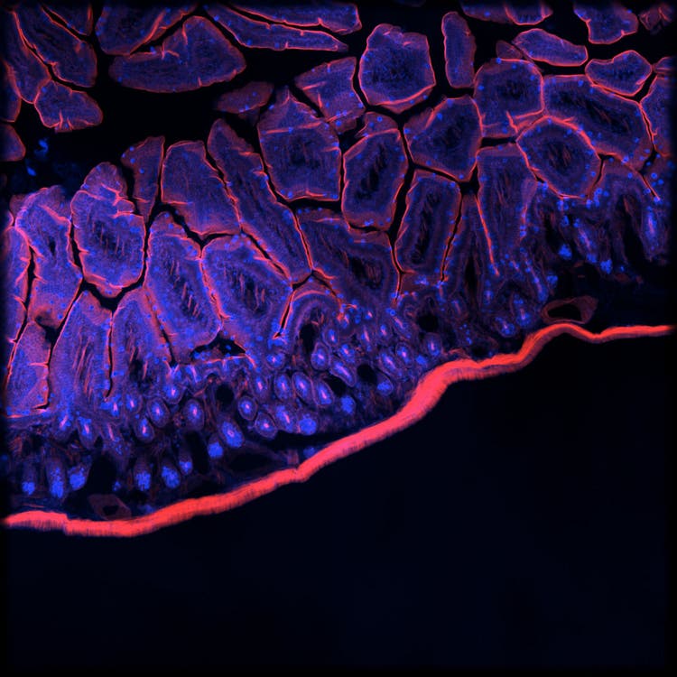 ImageXpress Micro Confocal Imaging System | Danaher Life Sciences