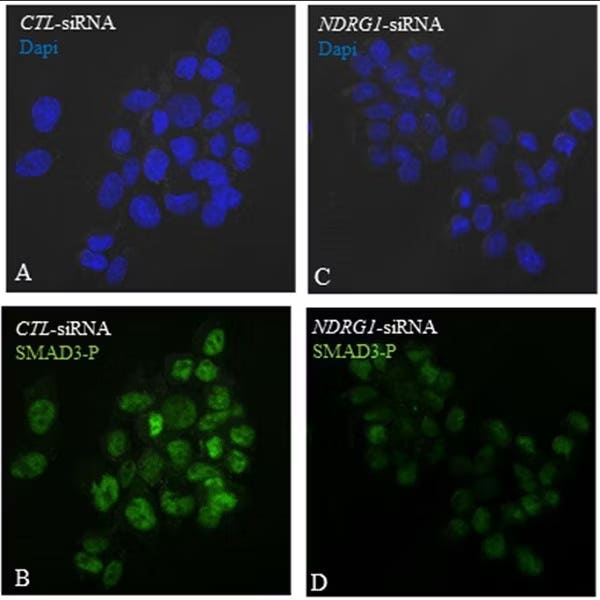 Anti-Smad3 Antibody – Phospho S423 + S425 (ab52903) | Danaher Life Sciences