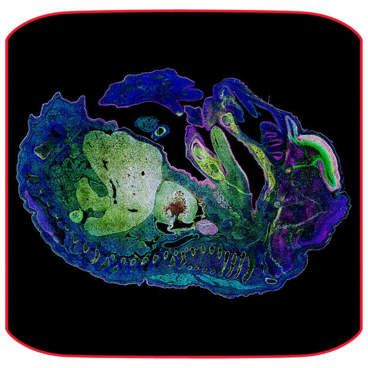MICA Microhub, Widefield & Confocal Imaging | Danaher Life Sciences
